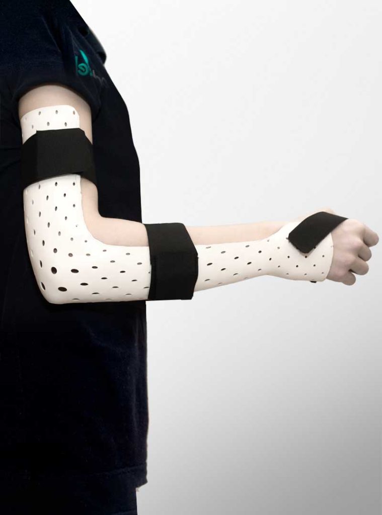 Splint for elbow and wrist joint support | ОРТОТЕХ | Ортопедични Обувки ...